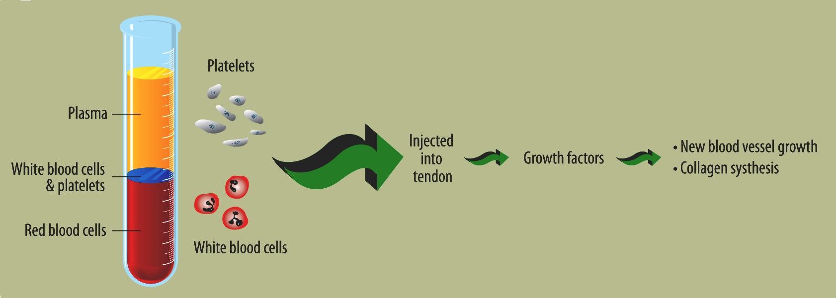 (PRP) Injections | Platelet-Rich Plasma | PRP Rejuvenation
